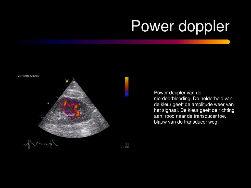 PPT - Ultrasound = echografie PowerPoint Presentation, free download ...