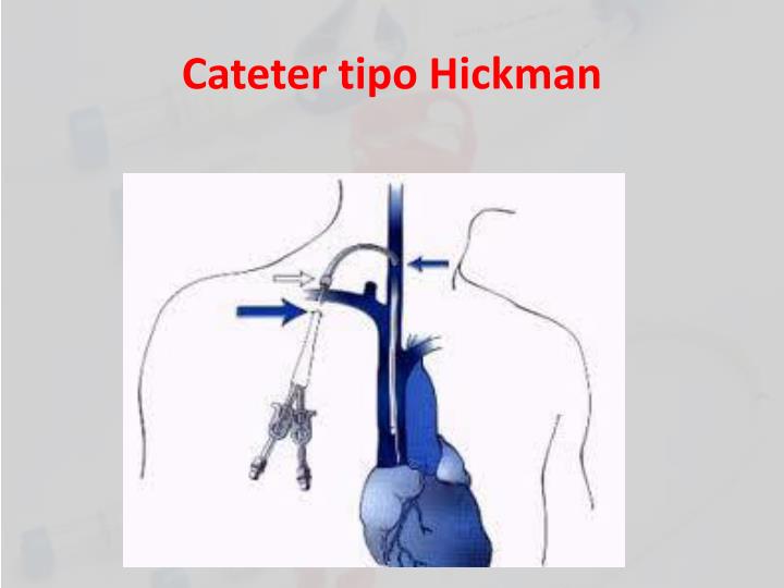 PPT - Cuidados de Enfermagem em pacientes críticos com cateter venoso ...