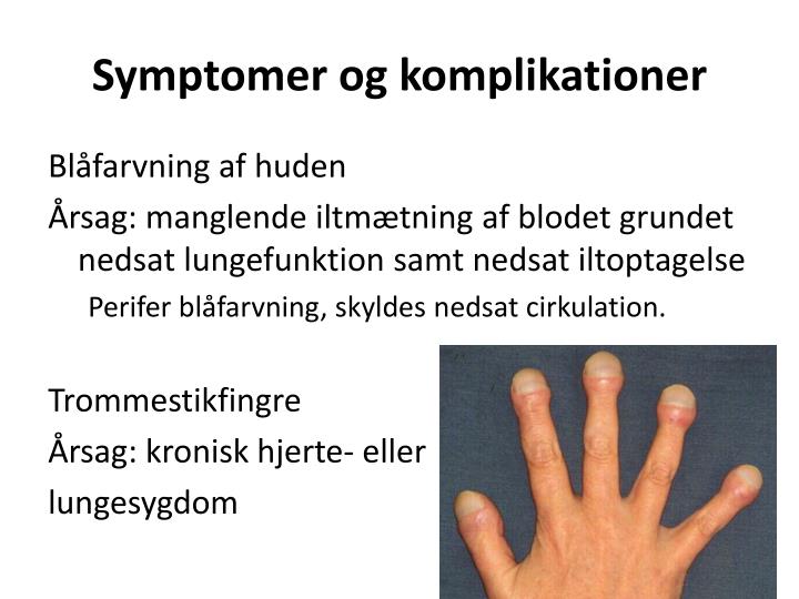 PPT - Respirationsorganernes sygdomme PowerPoint Presentation - ID:2047257