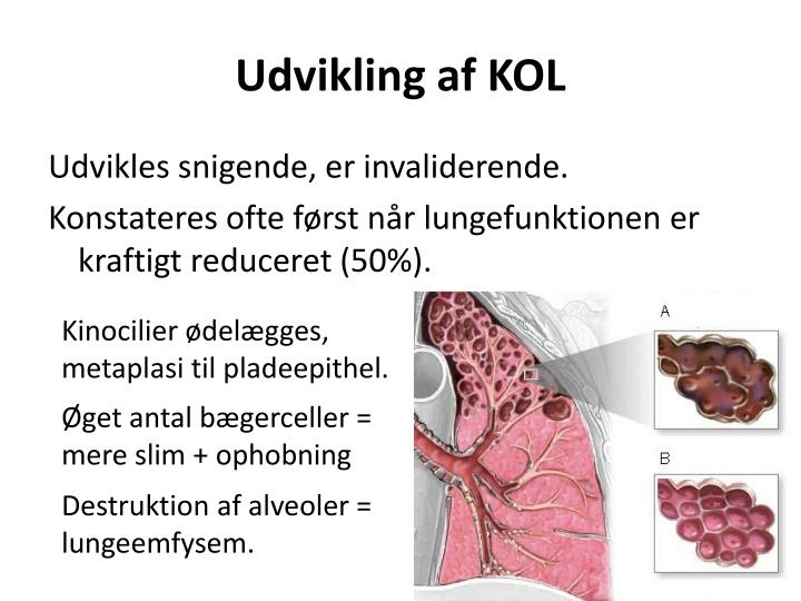 PPT - Respirationsorganernes sygdomme PowerPoint Presentation - ID:2047257