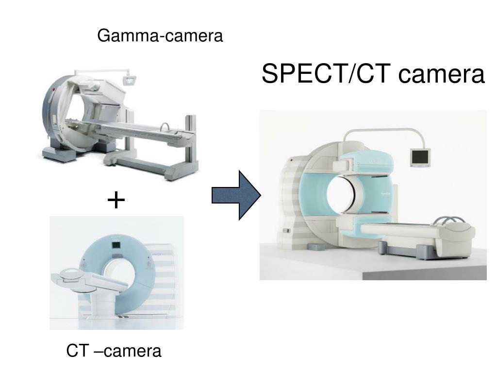 PPT - Meerwaarde van SPECT-CT bij skeletscintigrafie PowerPoint ...