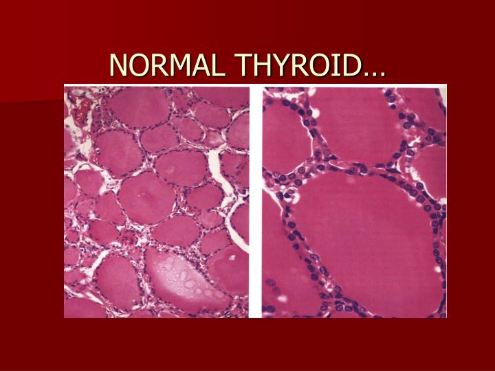 PPT - Thyroid Anatomy PowerPoint Presentation - ID:2047550