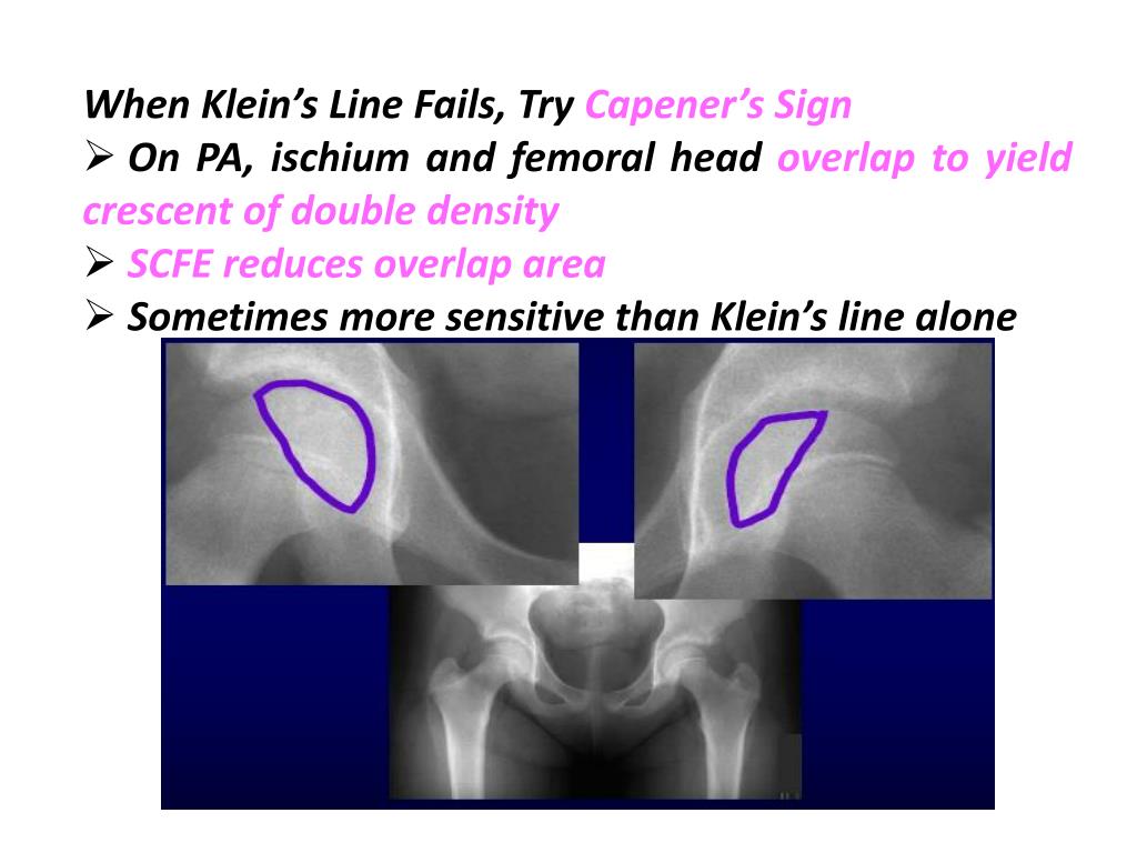 PPT - Neurologic and Musculoskeletal Imaging Studies Pediatric MSK ...