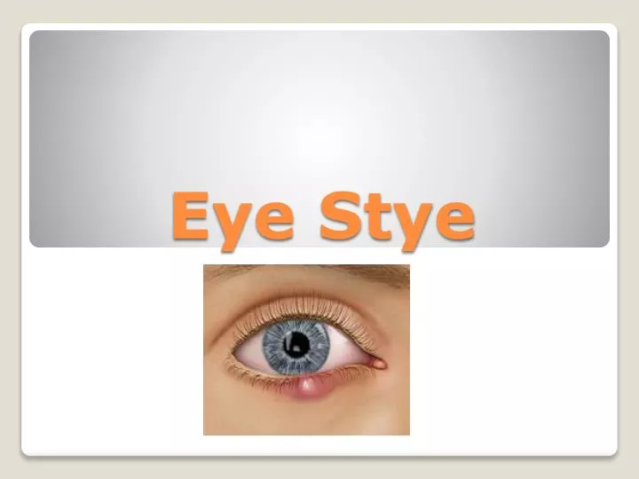 PPT - Eye Stye PowerPoint Presentation, free download - ID:2049097
