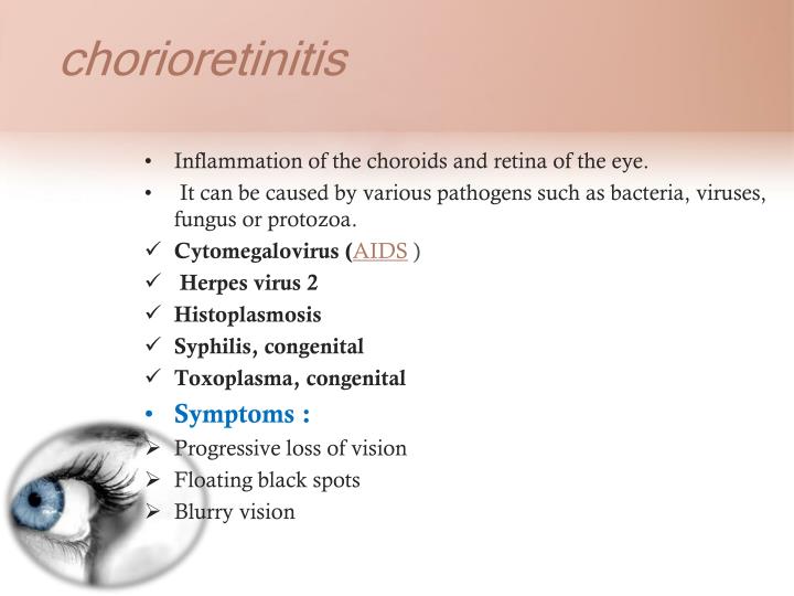 PPT - Eye infection PowerPoint Presentation - ID:2049121