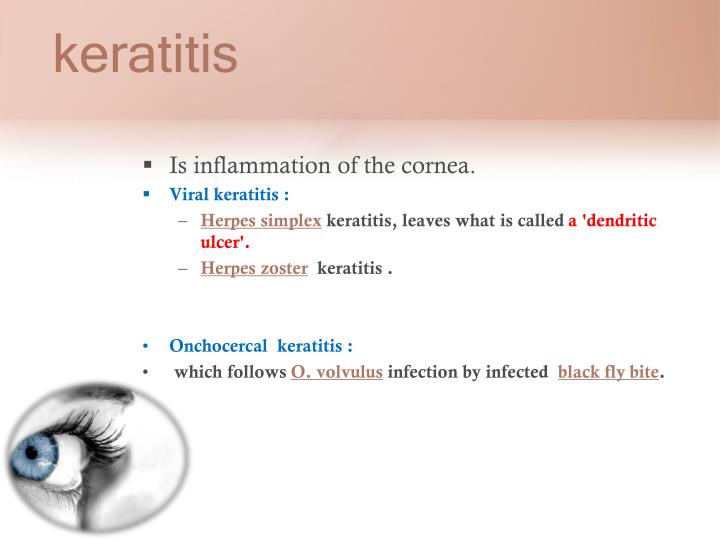 PPT - Eye infection PowerPoint Presentation - ID:2049121
