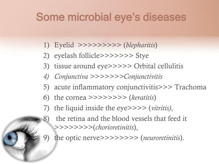 PPT - Eye infection PowerPoint Presentation - ID:2049121