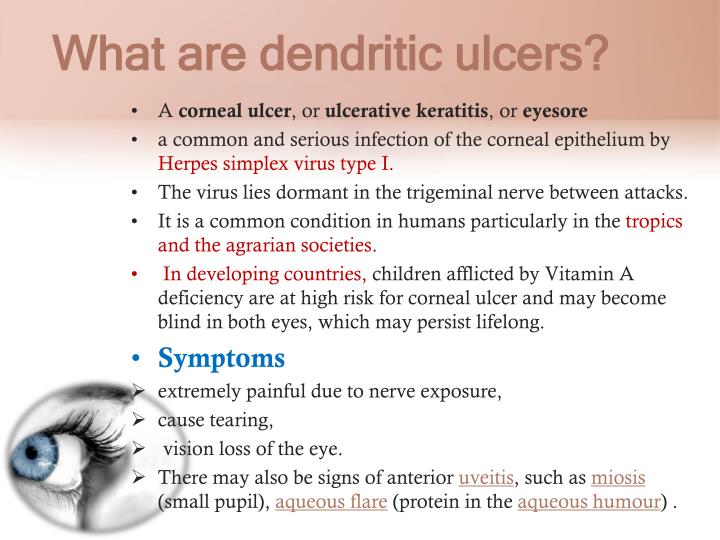 PPT - Eye infection PowerPoint Presentation - ID:2049121