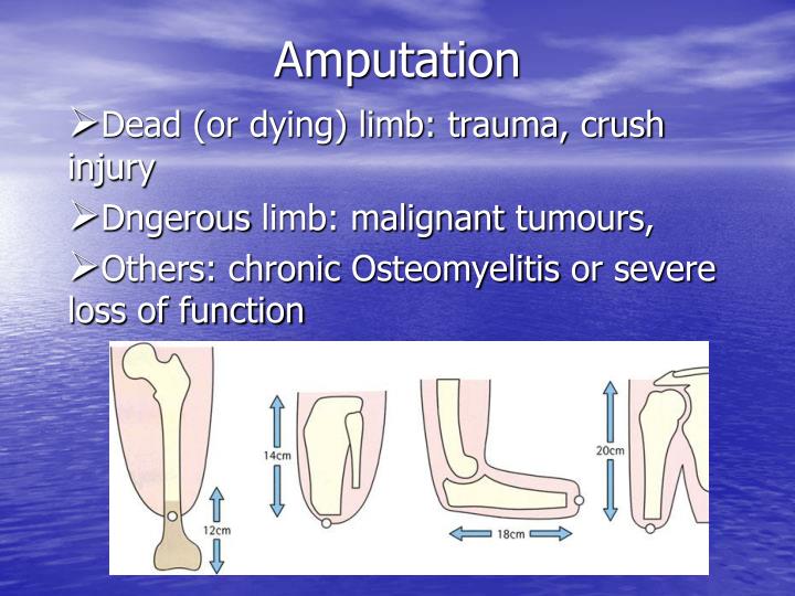 PPT - Principles of Surgical Treatment in Orthopedic Surgery PowerPoint ...