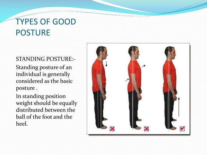 PPT - POSTURE N POSTURAL DEFORMITIES PowerPoint Presentation - ID:2049343