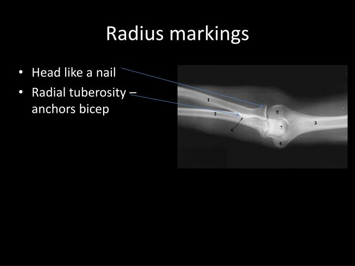 PPT - The Upper Limb aka The Arm PowerPoint Presentation - ID:2049575