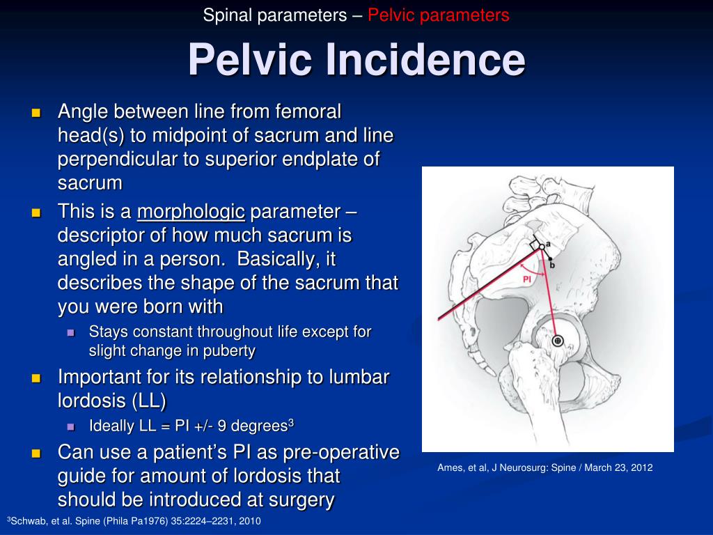 Ppt Scoliosis More Than Just Cobb Angles Powerpoint Presentation