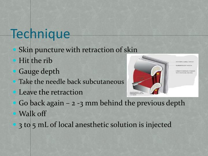 PPT - Intercostal nerve block PowerPoint Presentation - ID:2050204