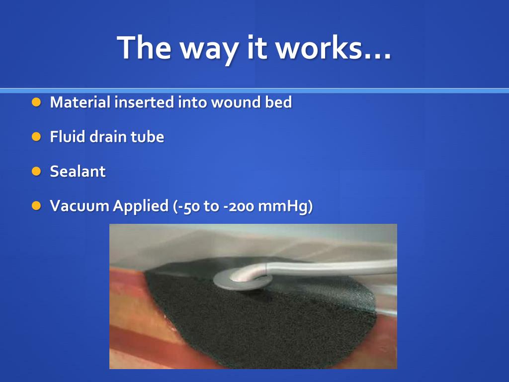 PPT - Determining Properties of Wound Dressings for Negative Pressure ...