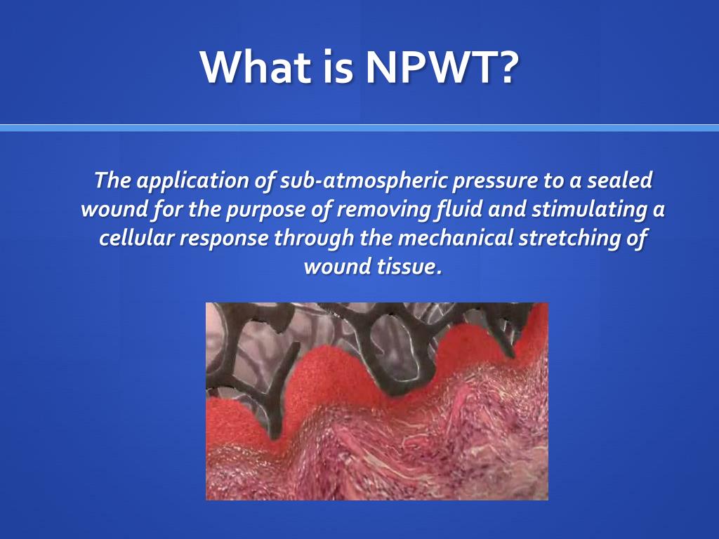 PPT - Determining Properties of Wound Dressings for Negative Pressure ...