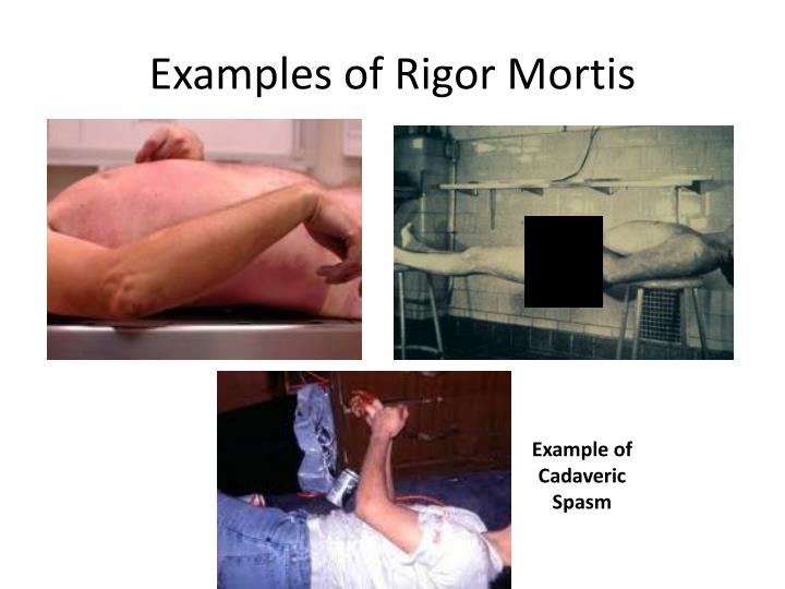 PPT - FORENSIC PATHOLOGY PowerPoint Presentation - ID:2052267