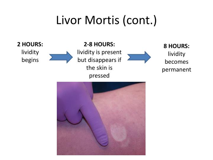 PPT - FORENSIC PATHOLOGY PowerPoint Presentation - ID:2052267