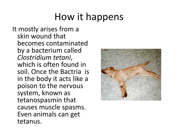 PPT - TETANUS PowerPoint Presentation - ID:2052759