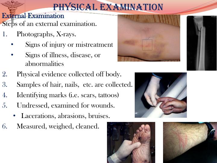 PPT - Why is a Forensic Autopsy preformed? PowerPoint Presentation - ID ...