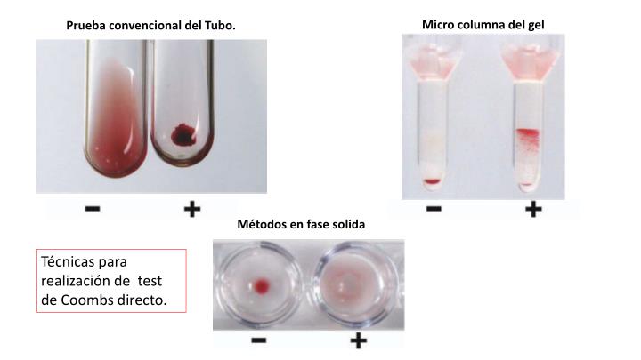 PPT - Test de Coombs Directo PowerPoint Presentation - ID:2054241
