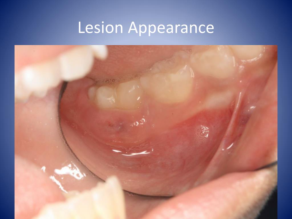 PPT - Oral Medicine and Oral Diagnosis Competency Case PowerPoint ...