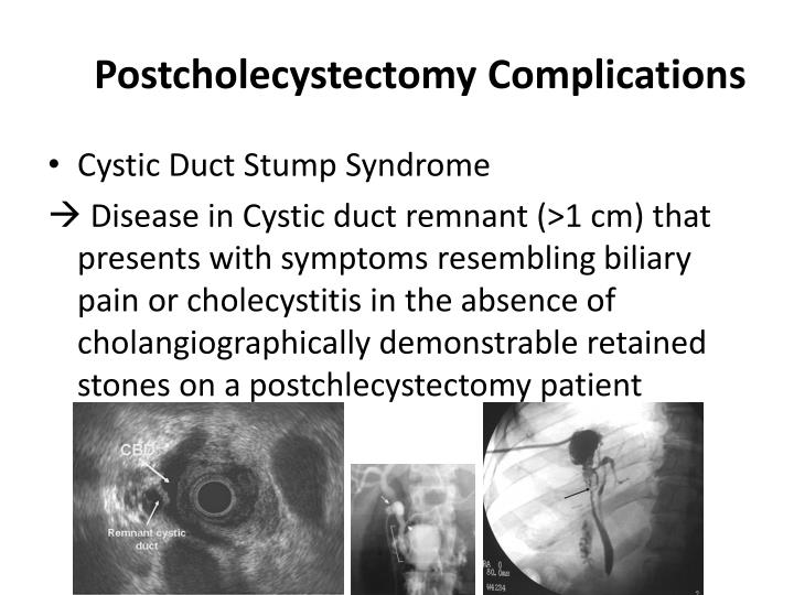 PPT - Limey (Milk of Calcium) Bile PowerPoint Presentation - ID:2055108