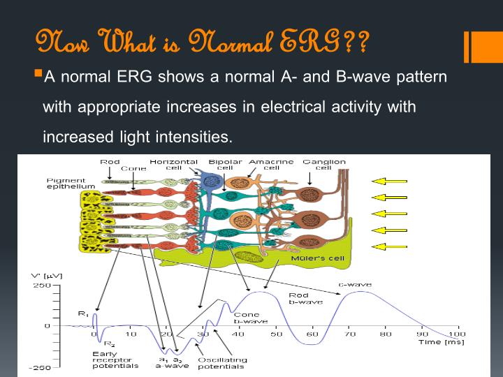 PPT - ElectroRetinoGraphy PowerPoint Presentation - ID:2055117