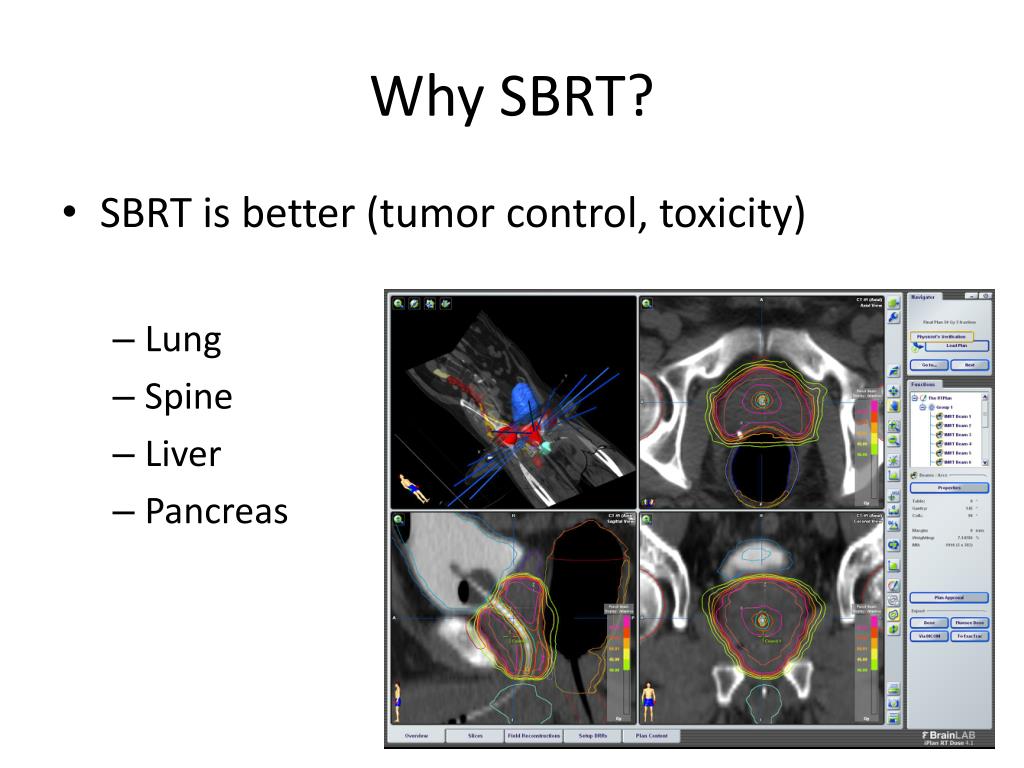 PPT - Yoshiya (Josh) Yamada MD FRCPC Department of Radiation Oncology ...