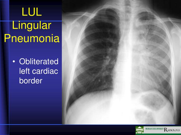 PPT - Inflammatory Conditions- Fetal Development PowerPoint ...