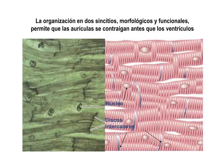 PPT - Discos intercalares PowerPoint Presentation, free download - ID ...