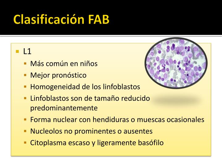 PPT - Leucemia Linfoblástica Aguda (LLA) PowerPoint Presentation - ID ...