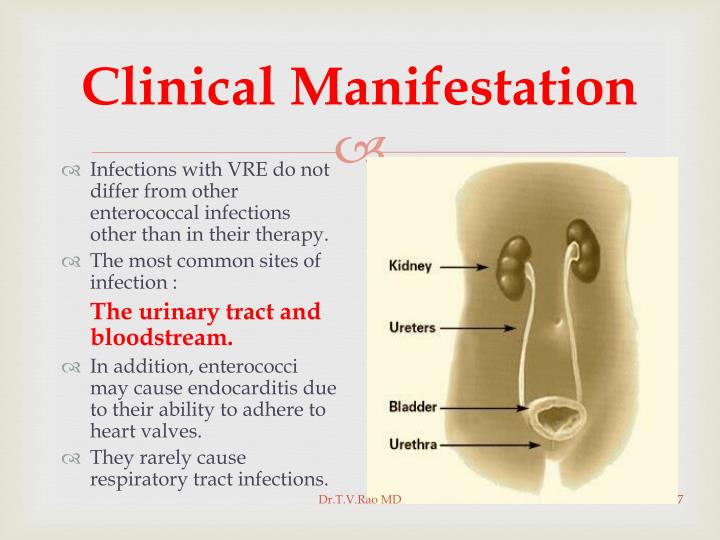 PPT - VANCOMYCIN RESISTANT ENTEROCOCCI PowerPoint Presentation - ID:2059274