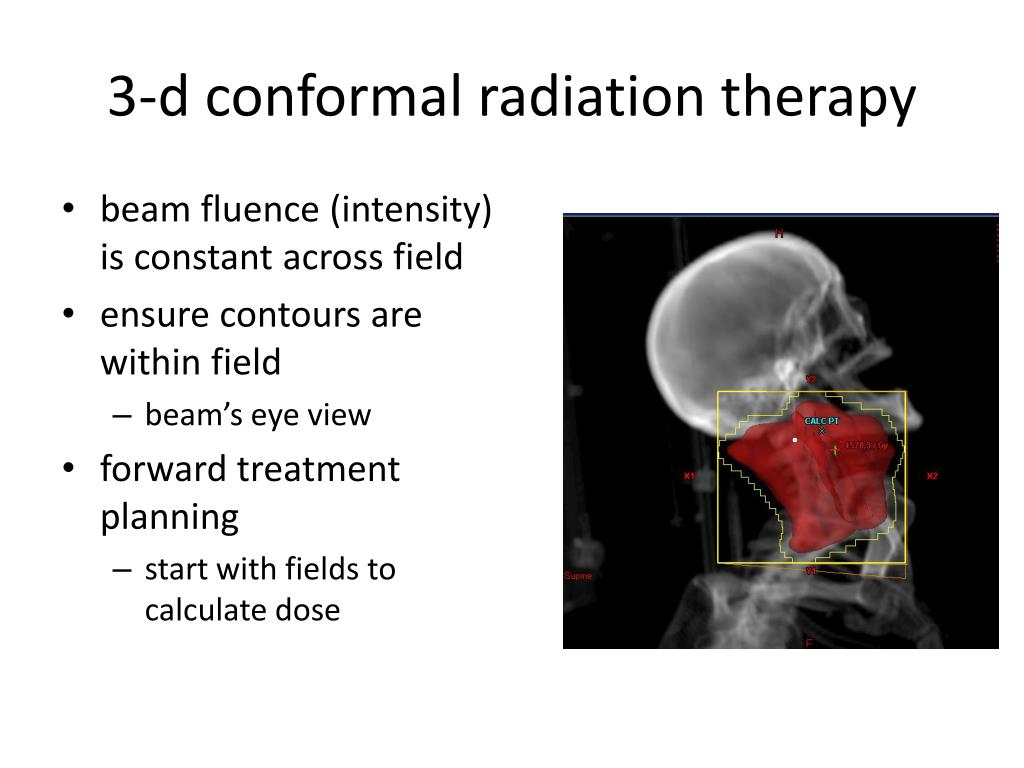 PPT - radiation therapy in cancers of the head and neck PowerPoint ...