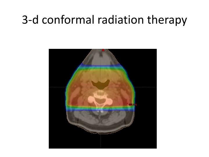 PPT - radiation therapy in cancers of the head and neck PowerPoint ...