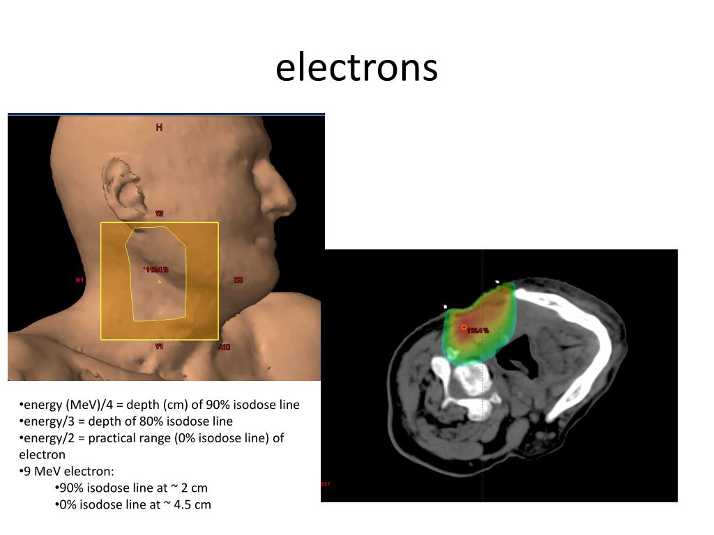PPT - radiation therapy in cancers of the head and neck PowerPoint ...