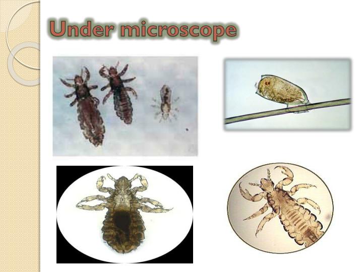 PPT - Lice PowerPoint Presentation - ID:2061608