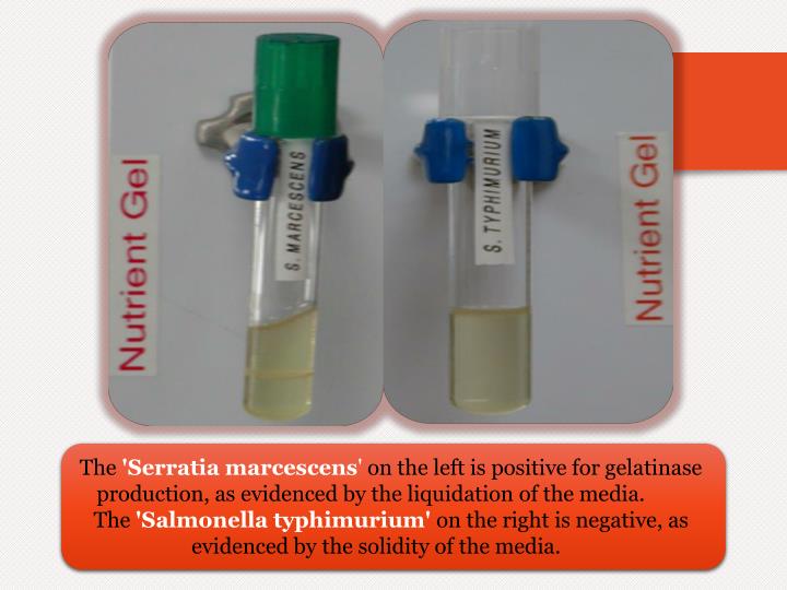 PPT - Amylase Production ( Starch Hydrolysis Test) PowerPoint ...
