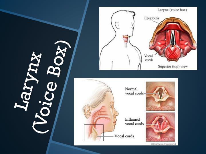 PPT - Laryngitis PowerPoint Presentation - ID:2062886