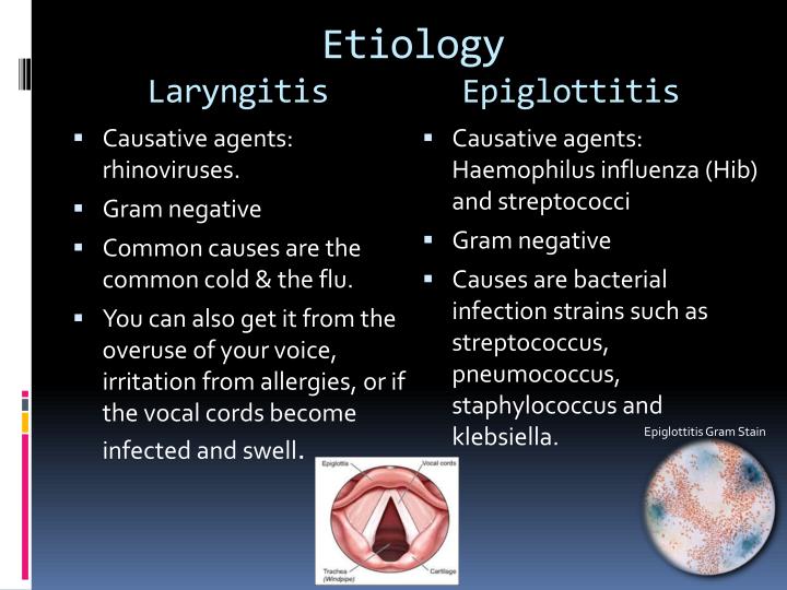 PPT - Laryngitis & Epiglottitis PowerPoint Presentation - ID:2062887