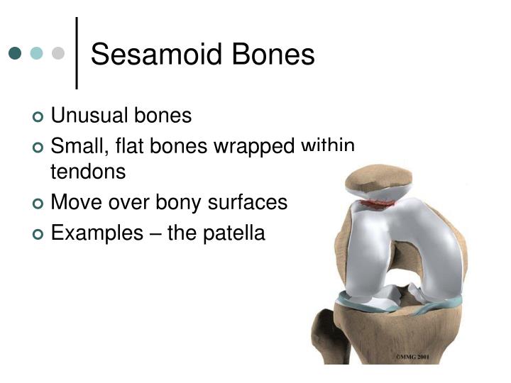 PPT - The Skeletal System PowerPoint Presentation - ID:2062912