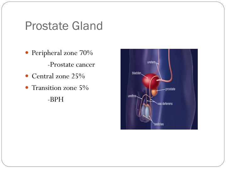 PPT - Neoplasms of the Prostate Gland PowerPoint Presentation - ID:2063288