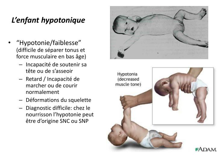 PPT - Maladies Musculaires Et Myasthenie Grave Pierre Bourque ...