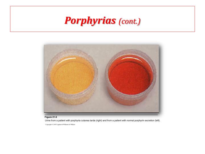 PPT - Porphyrin metabolism & porphyrias PowerPoint Presentation - ID ...