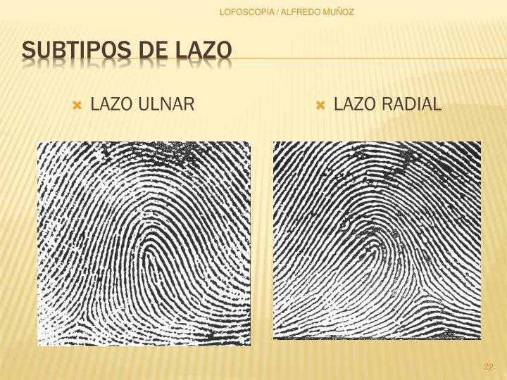 PPT - LOFOSCOPIA Generalidades PowerPoint Presentation - ID:2065461