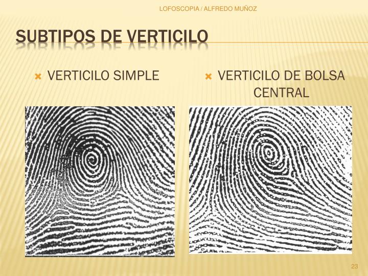 PPT - LOFOSCOPIA Generalidades PowerPoint Presentation - ID:2065461