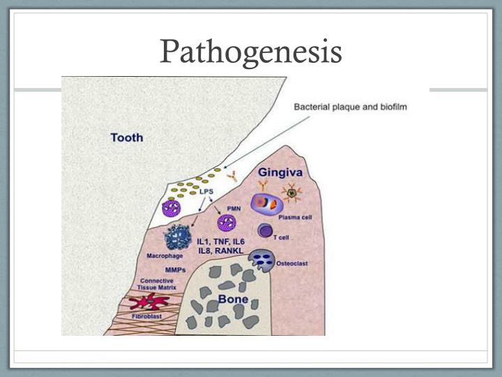 PPT - Periodontal Disease and Preterm Birth PowerPoint Presentation ...