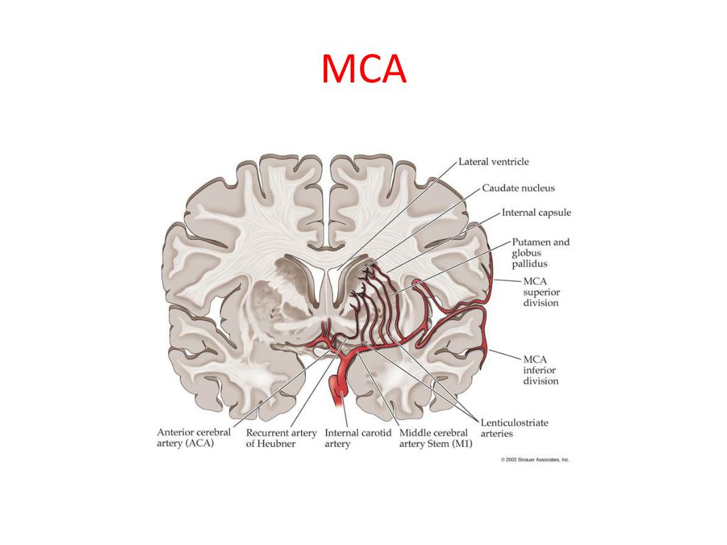 PPT - CEREBROVASCULAR DISEASES for medical students PowerPoint ...