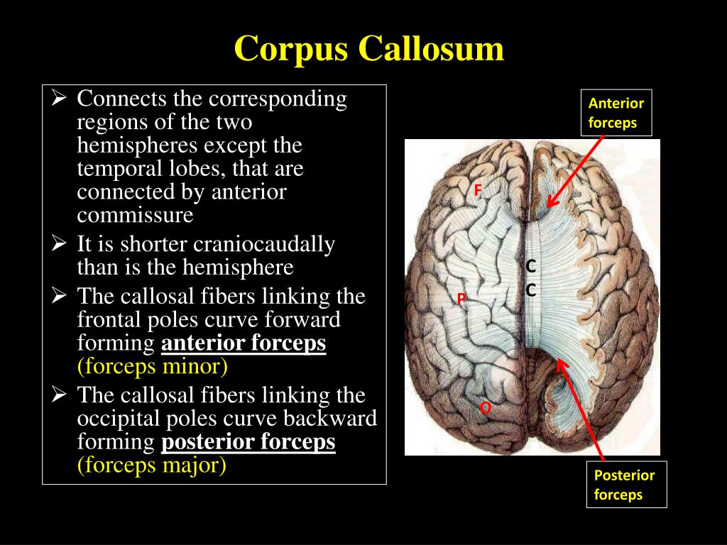 PPT - At 4 th week , e ach sclerotome becomes subvidided into two parts ...