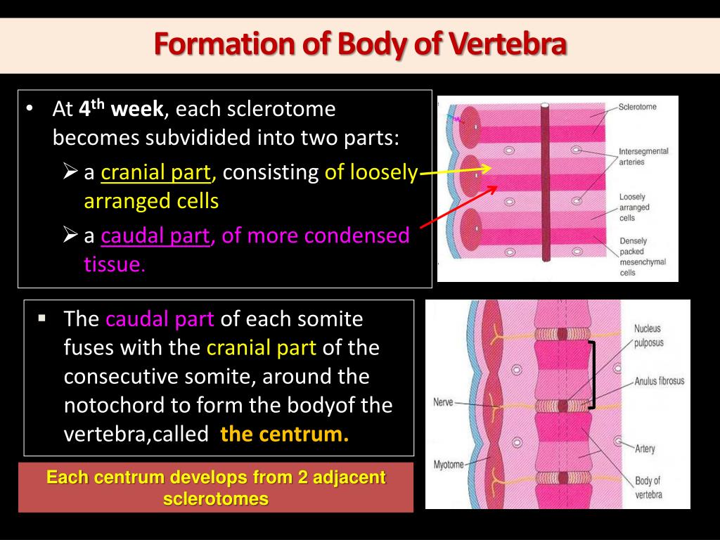 PPT - At 4 th week , e ach sclerotome becomes subvidided into two parts ...