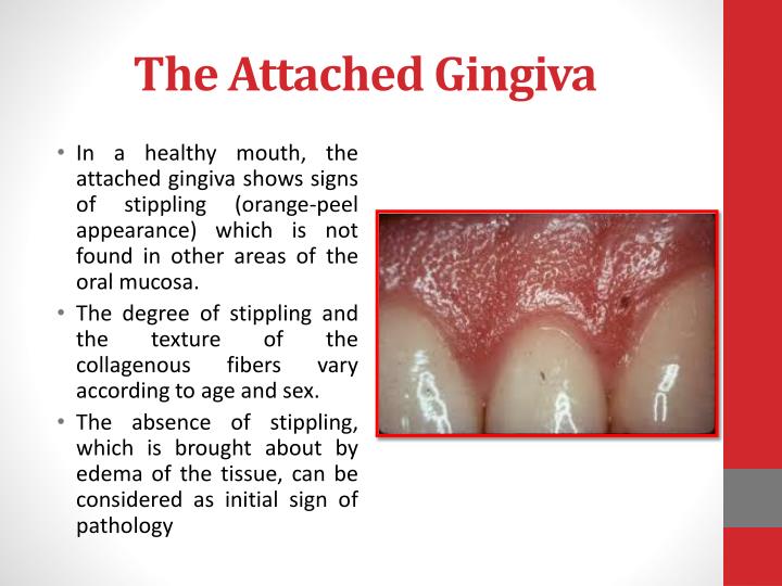 PPT - PERIODONTIUM PowerPoint Presentation - ID:2067263